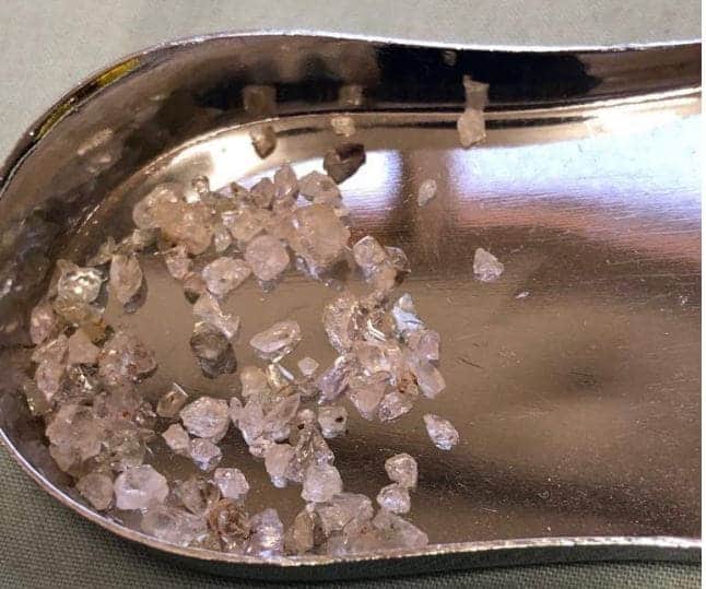 Merlin Diamonds recupera 32 diamantes rosados - .:: Minería en Línea